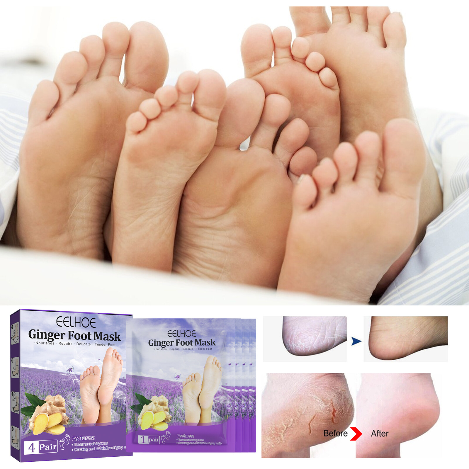 Eelhoe Ginger Exfoliating Foot Mask Moisturizing Nourishing Foot ...