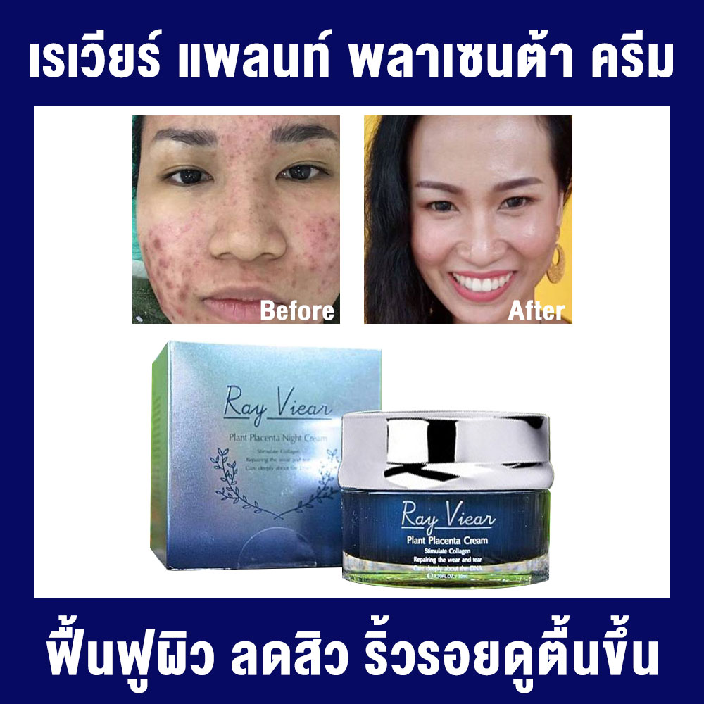 Ray Viear Perfect Ampoules - Rayviear Beauty Shop - ThaiPick