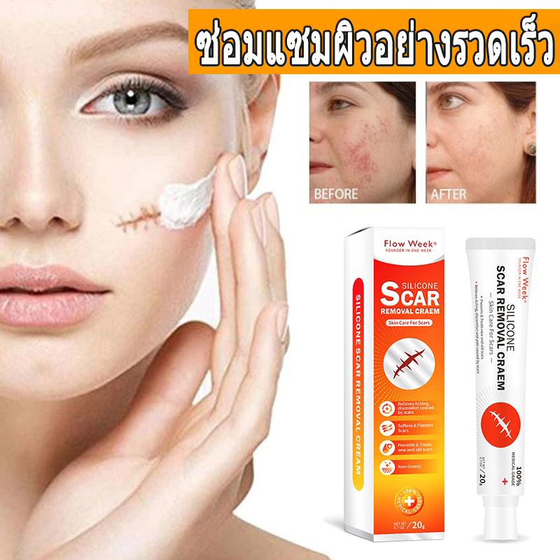 FlowWeek Scar Cream Sigh Scar Repair Scar Old Scar Blisters Bleeding ...