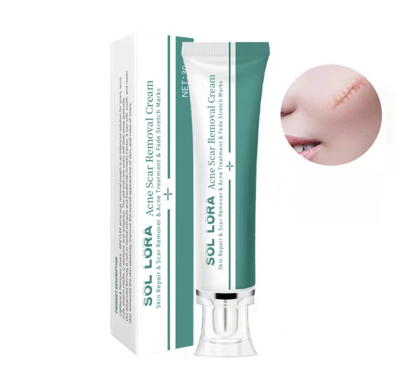 JP.6/ SOL LORA ครีมลบแผลเป็น 30g แผลเป็นนูน ครีมรอยแผลเป็น ลดแผลคีรอย | Lazada.co.th