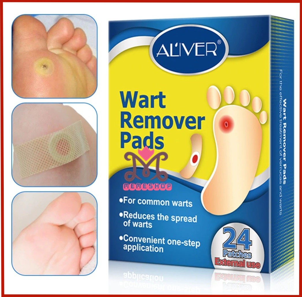 ALIVER Wart Remover Pads / Corn Remover 鸡眼贴 24 PATCHES PER BOX | Lazada ...