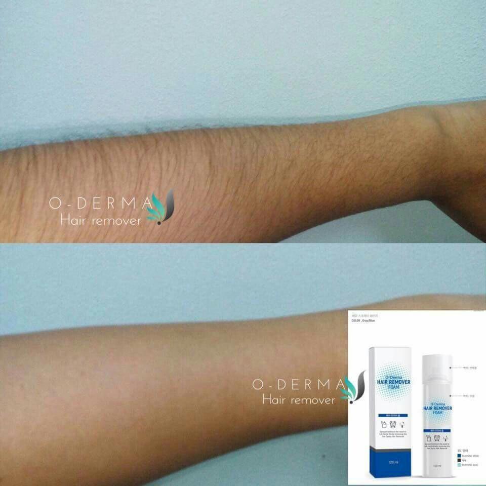 โอเดอร์มา แฮร์ รีมูฟเวอร์ โฟม O-Derma Hair Remover Foam (120ml) (X10) - Tongnoi Shop - ThaiPick
