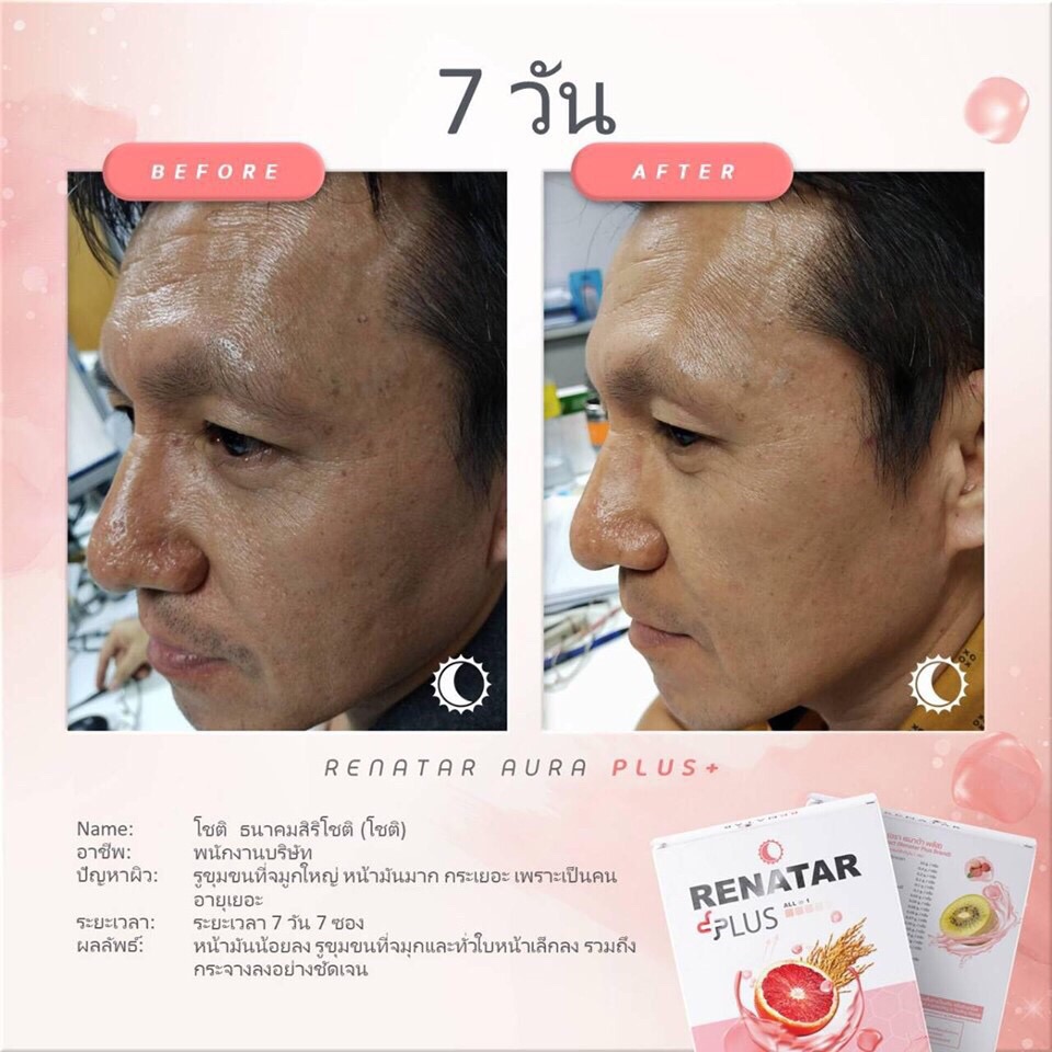 Renatar AuraPlus เรนาต้า ออร่าพลัส คอลลาเจนญี่ปุ่น 1กล่องมี10ซอง - n&k beauty - ThaiPick
