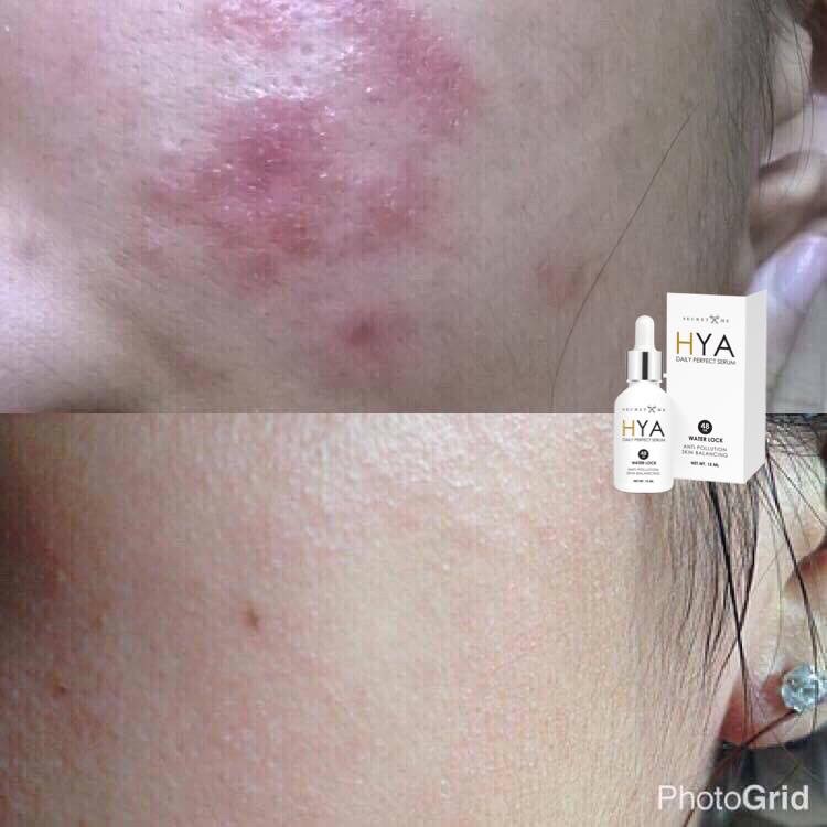 HYA Daily Perfect Serum SECRET ME - Aqlz - ThaiPick