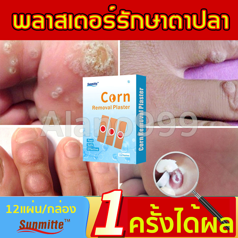 Anti Swelling Ginger Detoxing Patch Herbal Ginger Patch Detox Foot Pads ...