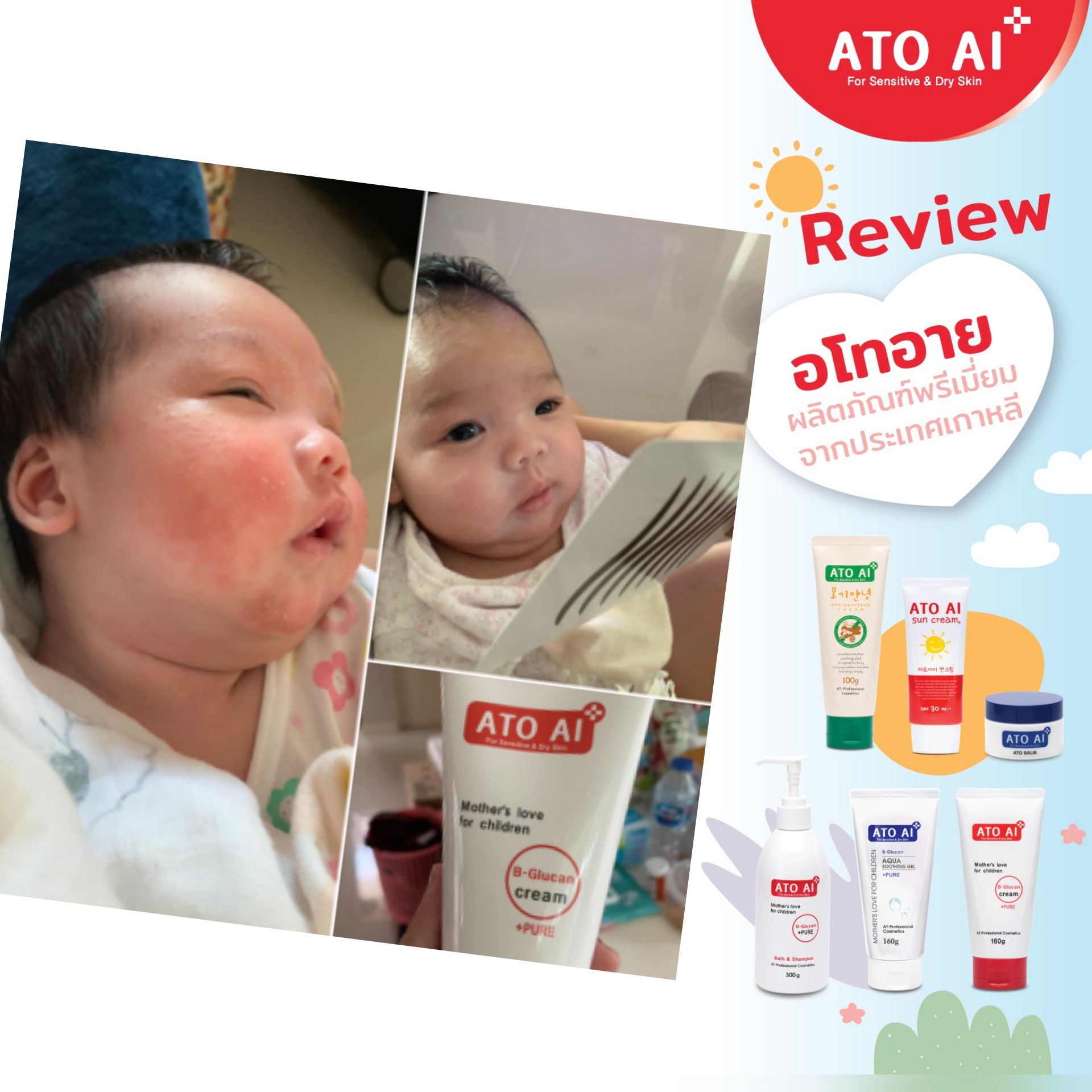Ato Ai Cream อโทอายครีม ทาผื่นแพ้ ผิวแห้ง ทาได้ตั้งแต่แรกเกิด - เบเบ้ ...