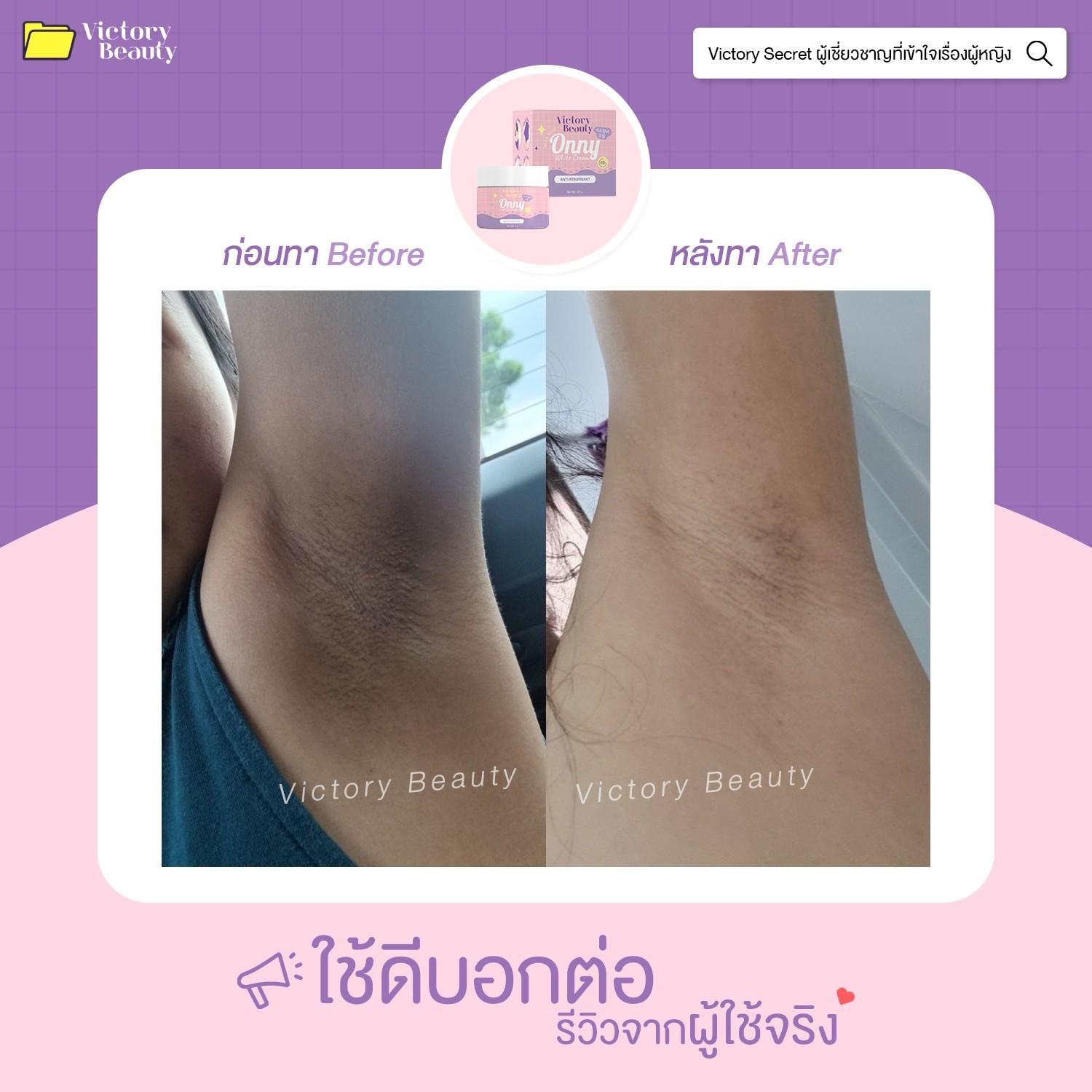 แท้100โทนเนอร์ ออนนี่ onny toner โทเนอร์ ครีมรักแร้แพท ครีมรักแร้ขๅว ...