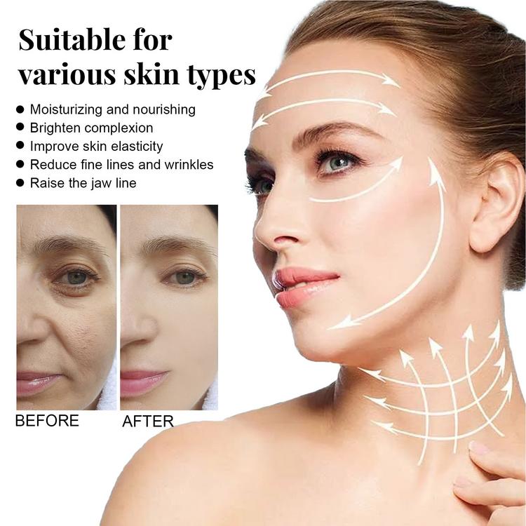 Protein Thread Lifting Kit Absorbable Collagen Thread Gold Protein ...