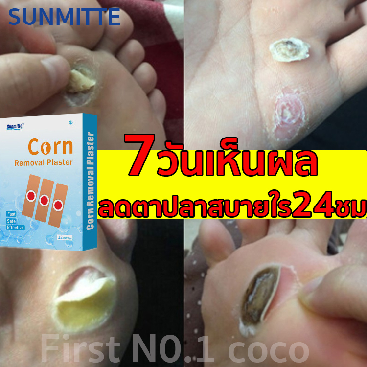 12ชิ้น/กล่อง Medical Plaster Foot Corn Callus Removal Thorn Plantar ...
