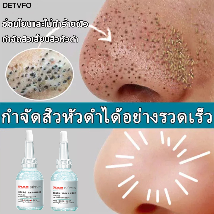 DETVFO เซรั่มกระชับรูขุมขน 32ml ขจัดสิวหัวดําสิวหัวดำหายไปหมด น้ำตบกระชับรูขุมขน เซรั่มลดสิว เซ ...