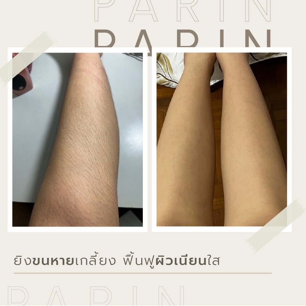 PARIN IPL LASER MULTI FUNCTION GEN3 - Parinthailand - ThaiPick