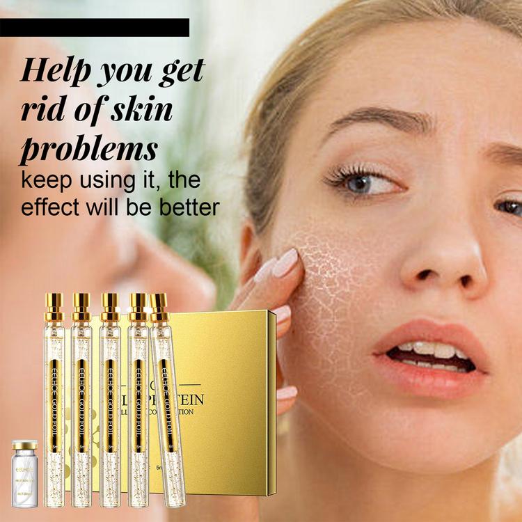 Protein Thread Lifting Kit Absorbable Collagen Thread Gold Protein ...