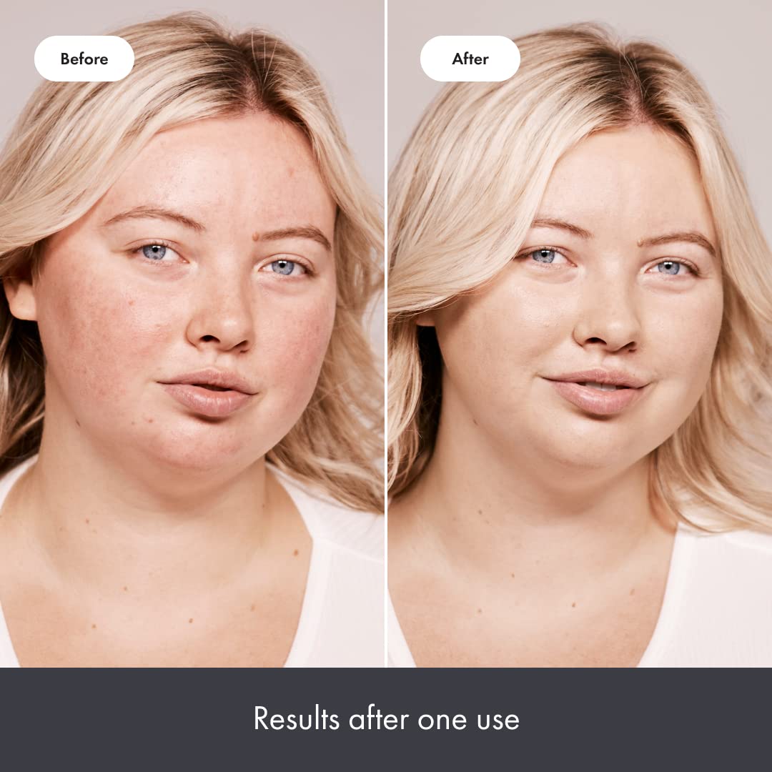 [Hero Cosmetics] Rescue Balm Post-Blemish Recovery Cream 15 ml บาล์ม ...