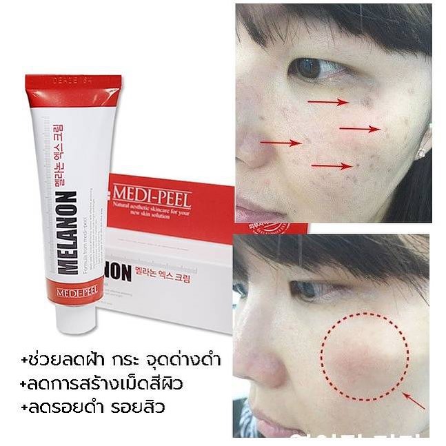 แท้/พร้อมส่ง Med-peel Medipeel melanon X cream 30ml. Centella Mezzo ...