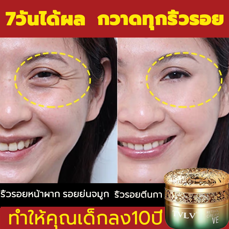 1ขวดช่วยให้คุณมีผิวที่ดีTVLVครีมลดเลือนริ้วรอย เลือนริ้วรอย ริ้วรอยลำคอ ...