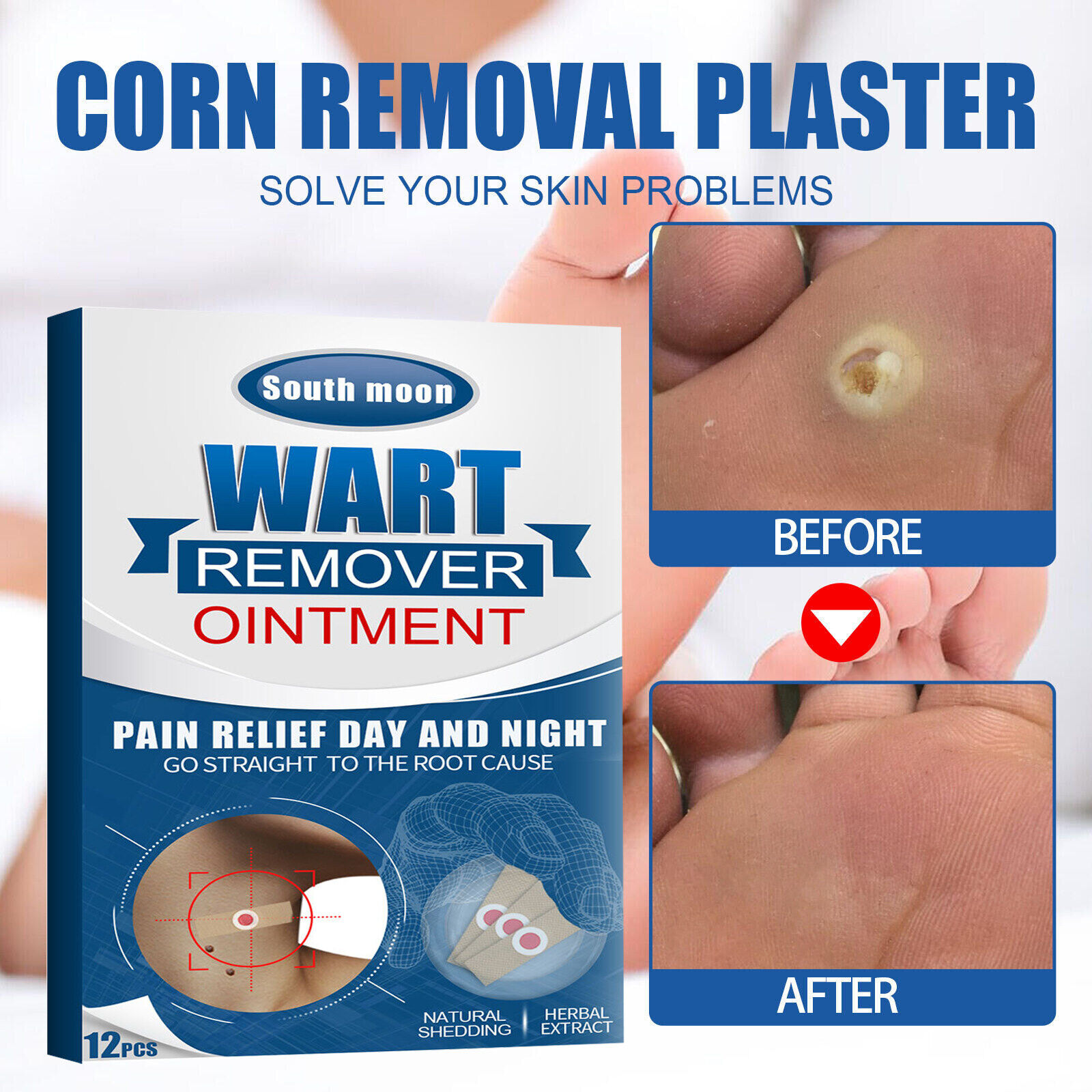 12แผ่นกล่อง South Moon Wart Corn remover pads แผ่นแปะตาปลา พลาสเตอร์ ...