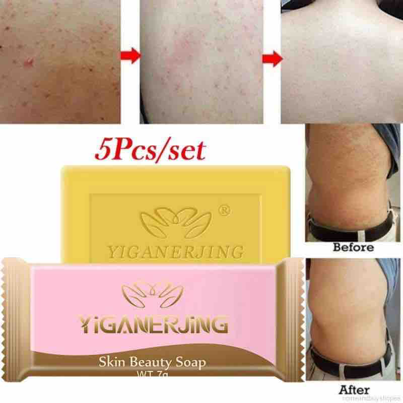 ของแท้ 100% Zudaifu Cream ครีมสมุนไพรจีนเป็นต้นฉบับครีมทาบรรเทาโรค ทา ...