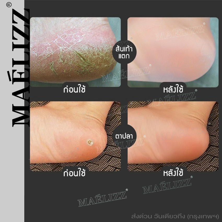 bkk ส่งฟรี 2 ชิ้น(ซ้ายขวา)Maelizz ซิลิโคนรองส้นเท้า สีเนื้อ แก้เจ็บส้น รองช้ำ ส้นเท้าแตก ใส่ได้ ...