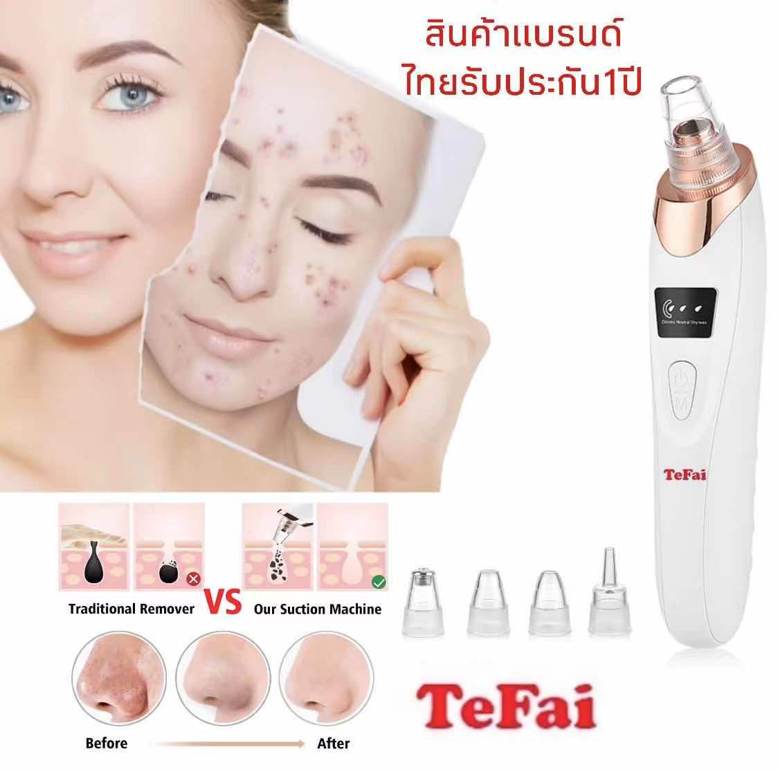 เครื่องดูดสิวเสี้ยน TeFai HY9 ขจัดสิ่งสกปรกบนใบหน้า เครื่องดูดสิวหัวดำมาพร้อมหัวเปลี่ยน 5 หัว ...