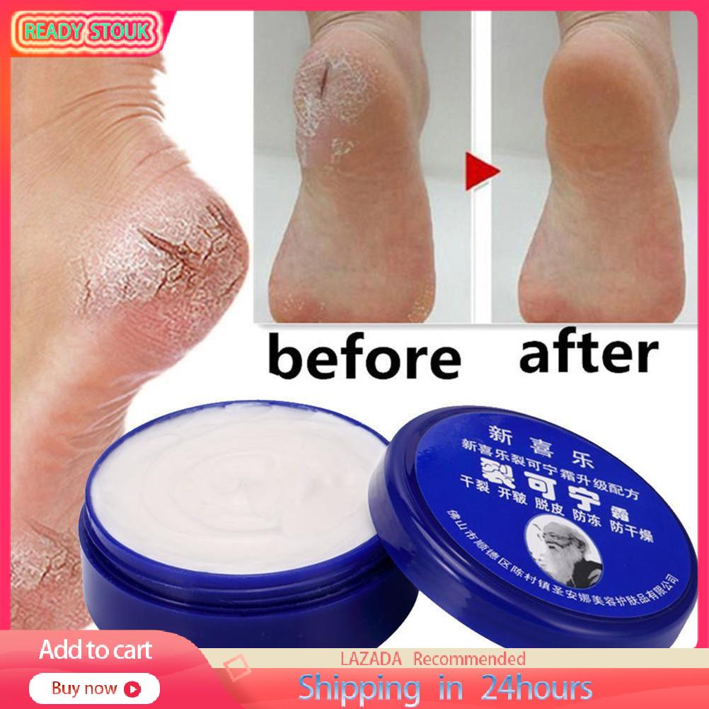 Hand Foot Crack Cream Anti Dry Chapped Cream Dry Skin Heel Chapped ...
