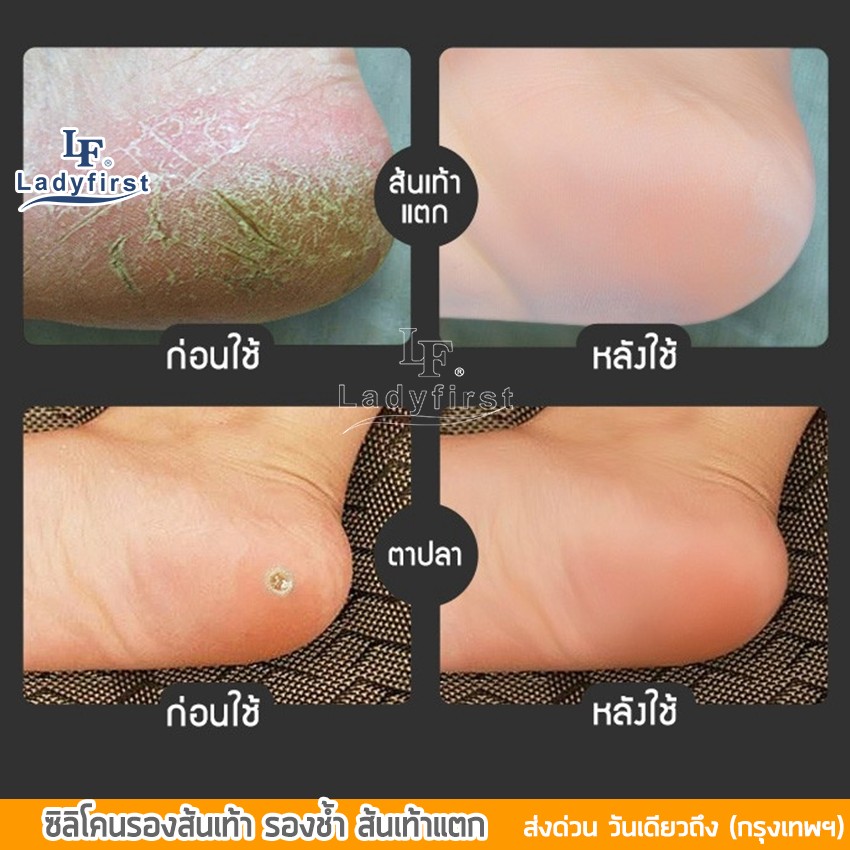 LF LadyFirst 2 ชิ้น(ซ้าย+ขวา) LOV ซิลิโคนรองส้นเท้า แก้เจ็บส้น รองช้ำ ส้นเท้าแตก ใส่ได้ทั้งชาย ...