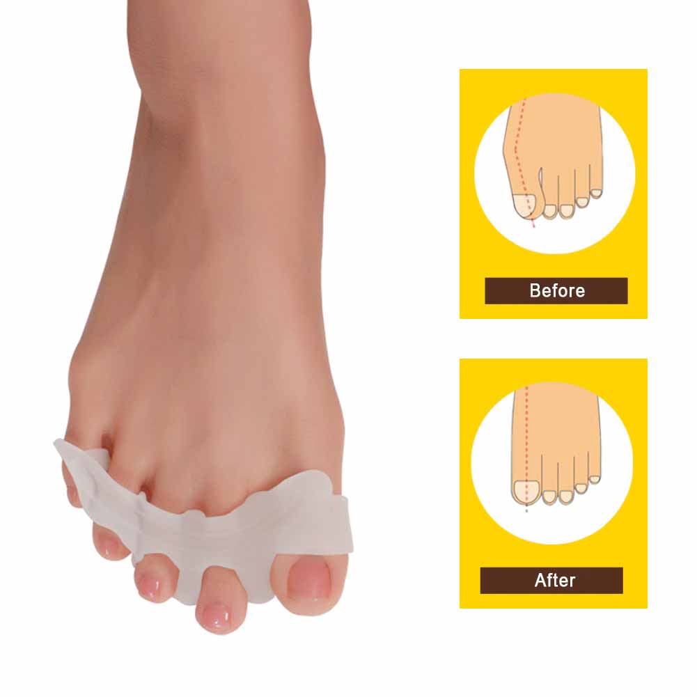 2pcs Toe Bunion Splint Straightener Separator Spacer Pain Relief - f6u4 ...