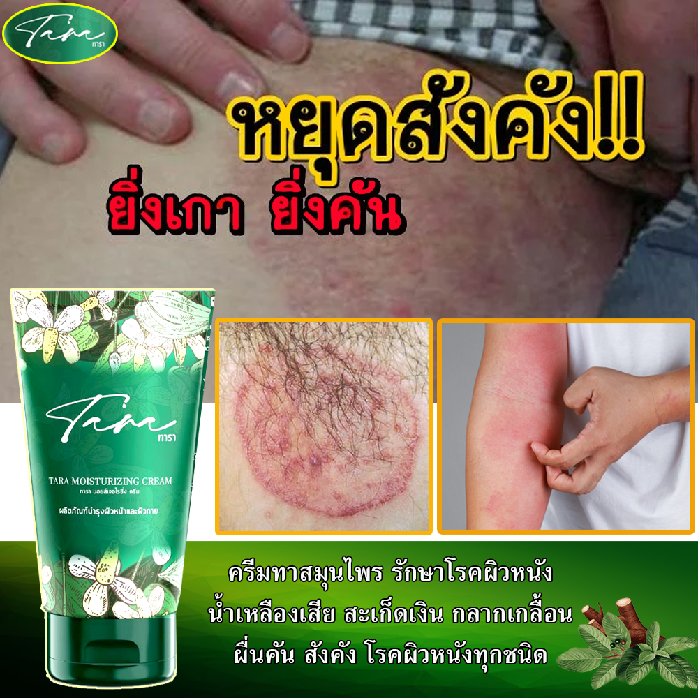 👍พร้อมส่ง👍 สมุนไพร ครีมทารา ทาแก้อาการคันในร่มผ้า (สังฆัง) ยาทาสังคัง ...