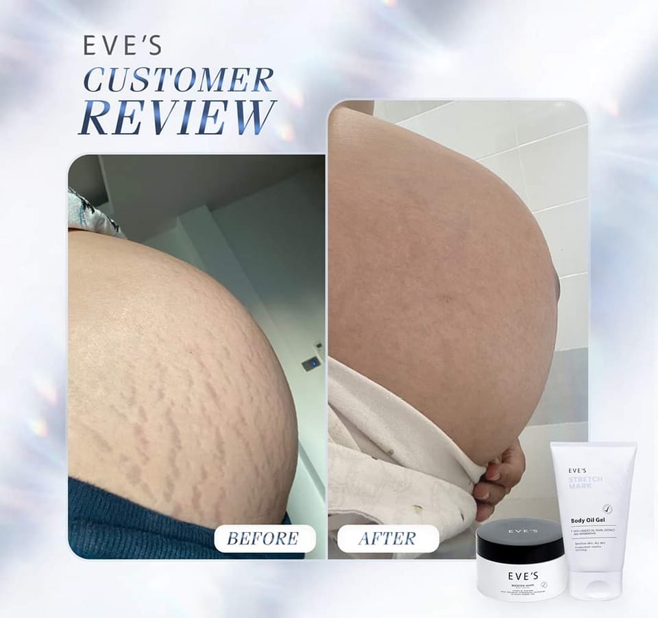 EVE'S SET ลดรอยแตกลาย x 2 (บูสเตอร์อีฟส์+อีฟส์ออย) ครีมคนท้อง ตั้งครรภ์ ทาท้องลาย ขาลาย ผิวแห้ง ...