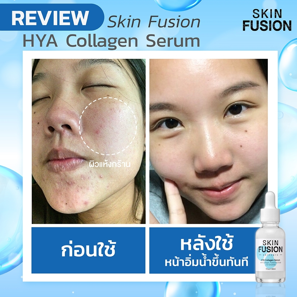 SKIN FUSION คอลลาเจน เซรั่ม Hya Collagen Serum เซรั่มหน้าใส ครีมบำรุง ...
