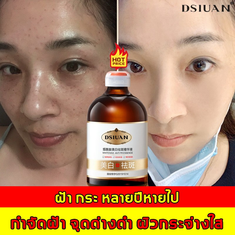 ทําให้จุดต่างๆ หายไปจากใบหน้า！DSIUAN ครีมทาฝ้า 100ml ที่ทําให้คุณเปล่ง ...