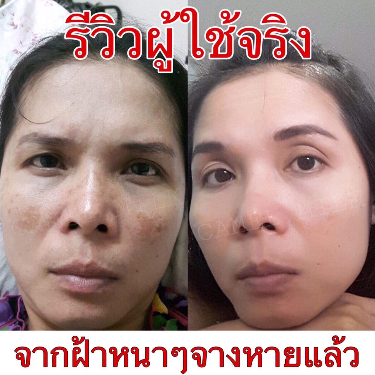 LUXE CAMEL MILK MOUSSE+CAMEL MILK MELANO LIFTING MASK (แพคเกจใหม่) ช่วย ...