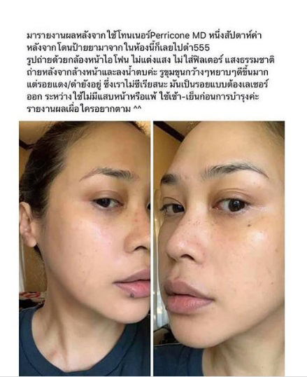 Perricone Md NoRinse Intensive Pore Minimizing Toner 118ml โทนเนอร์ คุม ...