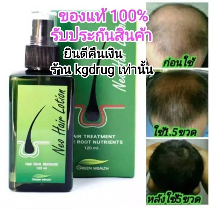 Shop online with neohair officialthailand now! Visit neohair ...